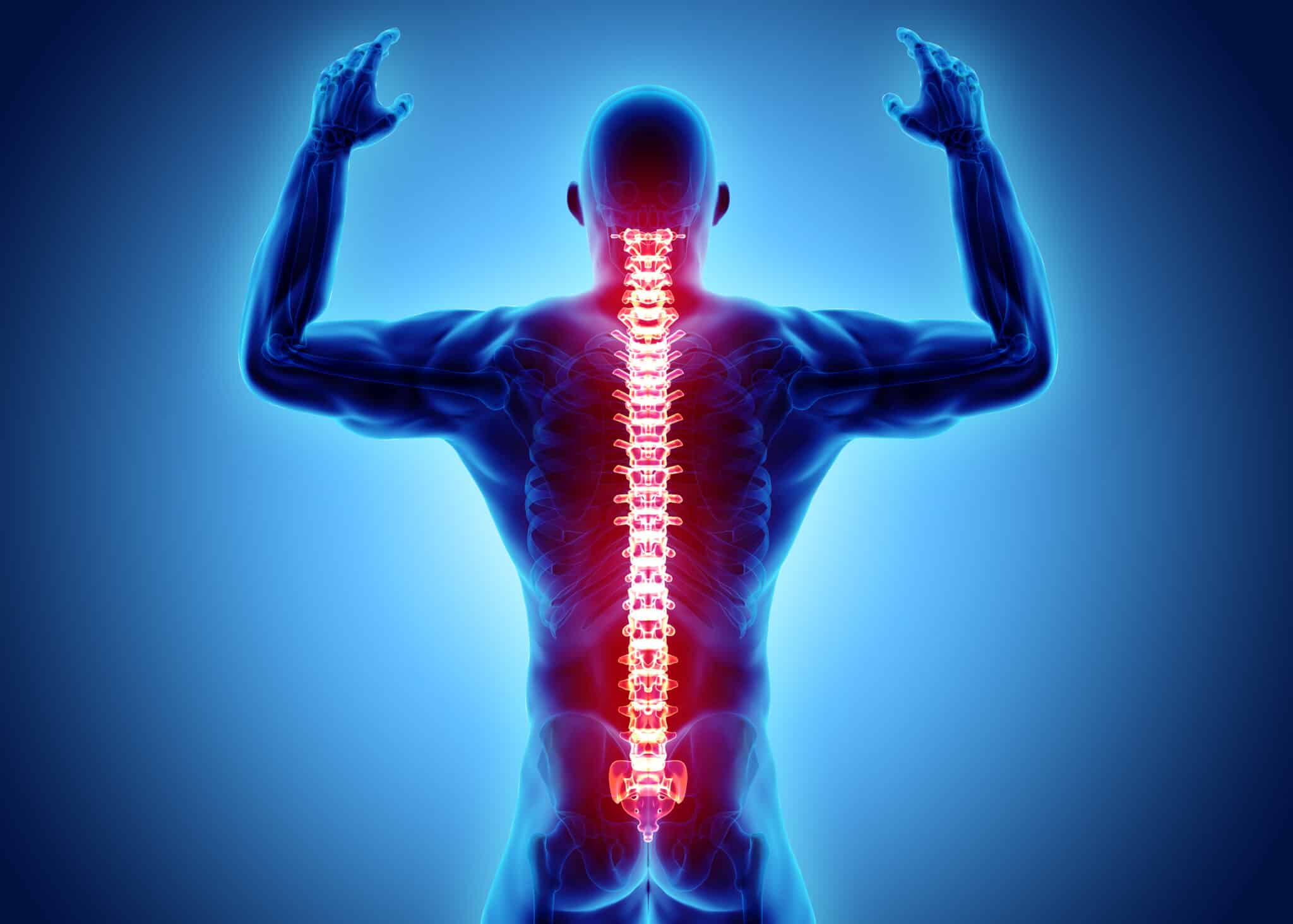 How Cervical Spine Surgery Protects Against Spinal Cord Damage